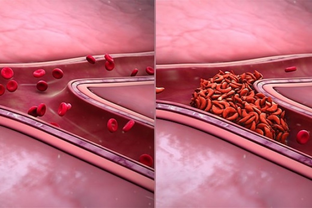 Técnica CRISPR de edição genética revela mecanismo biológico por trás ...
